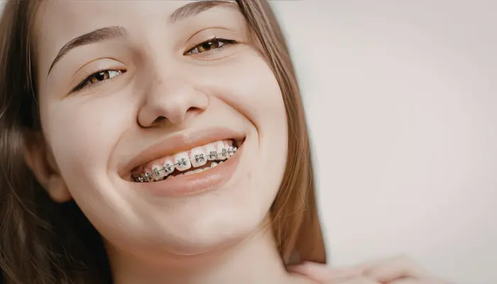 Smile Designs in Miami | Nova Dental Studio